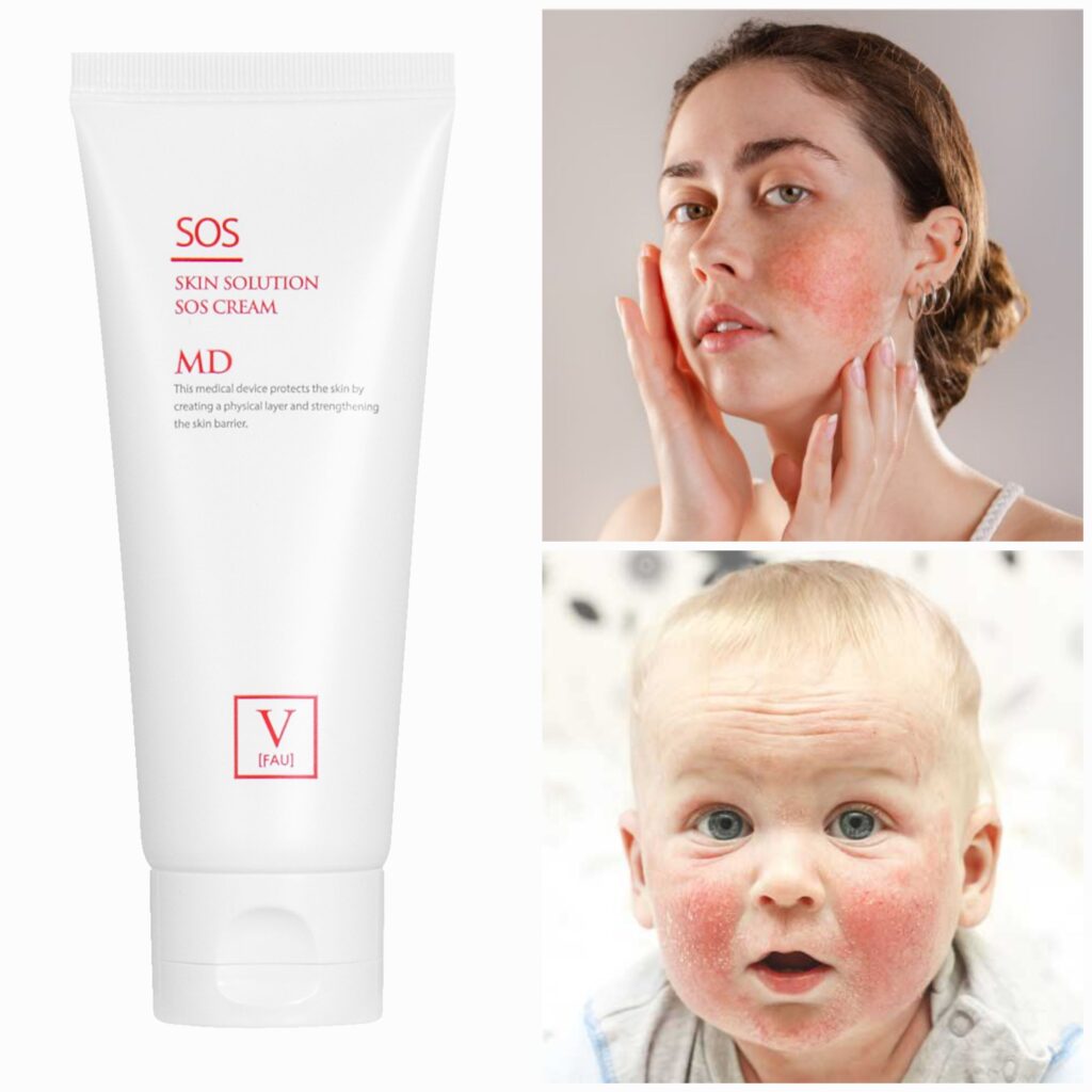 FAU SKIN SOLUTION SOS CREAM MD Medical Device odos barjerą apsaugantis ...